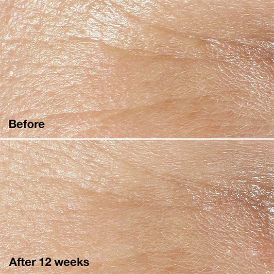 Skin Firming Products | Best Skincare Products to Firm Skin | Clinique
